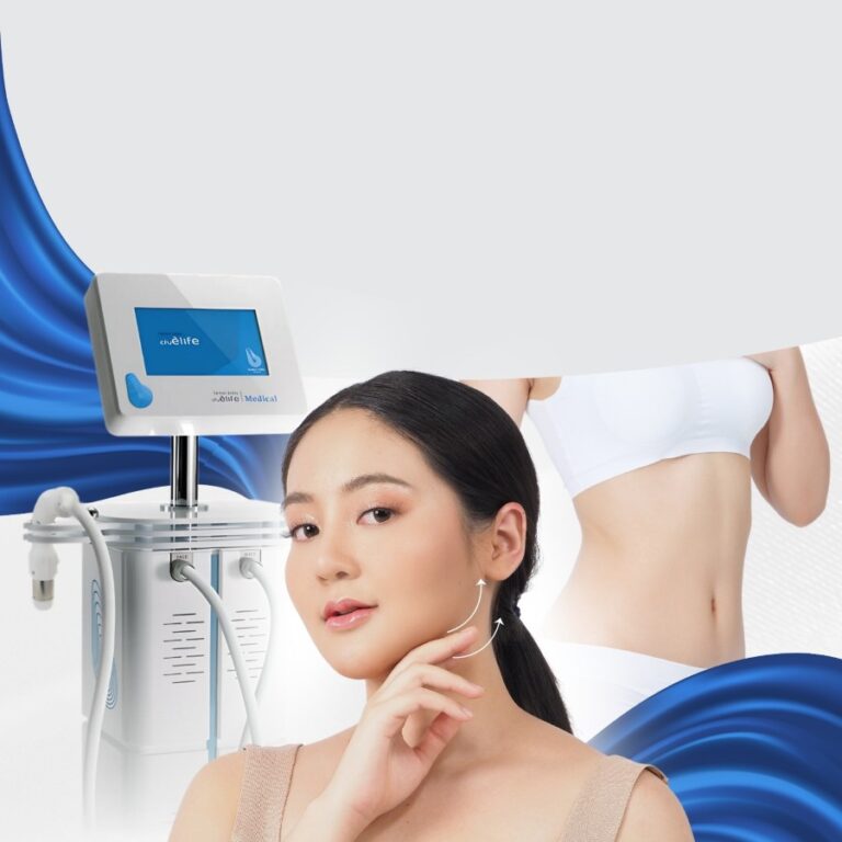 Công nghệ CFU Elife: Giải pháp nâng cơ – trẻ hóa – hủy mỡ an toàn